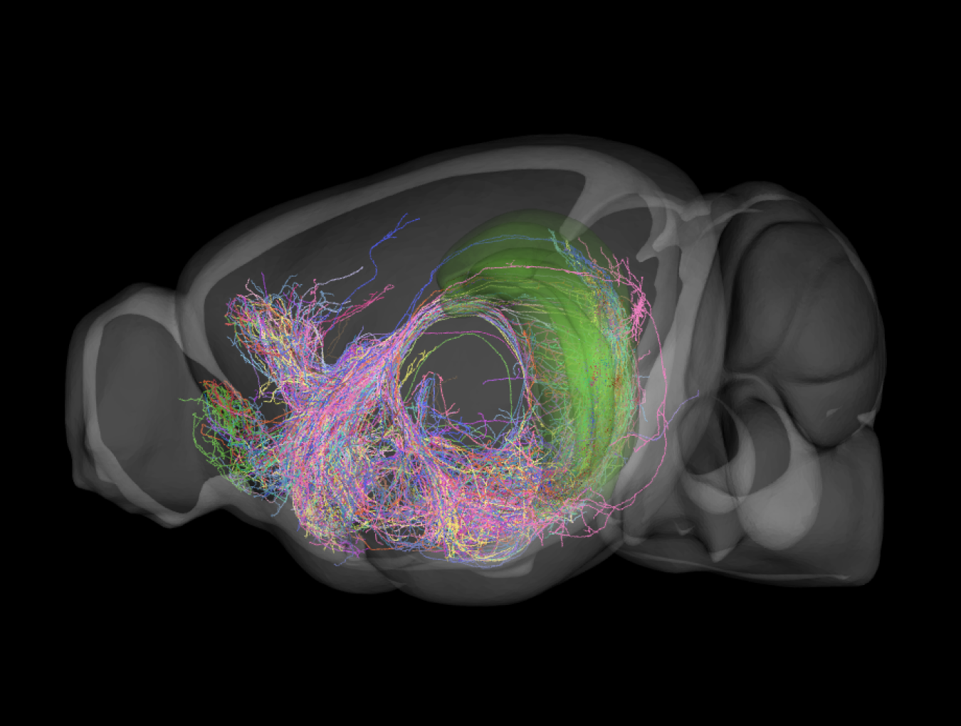 Digital Brain Cebsit Ion